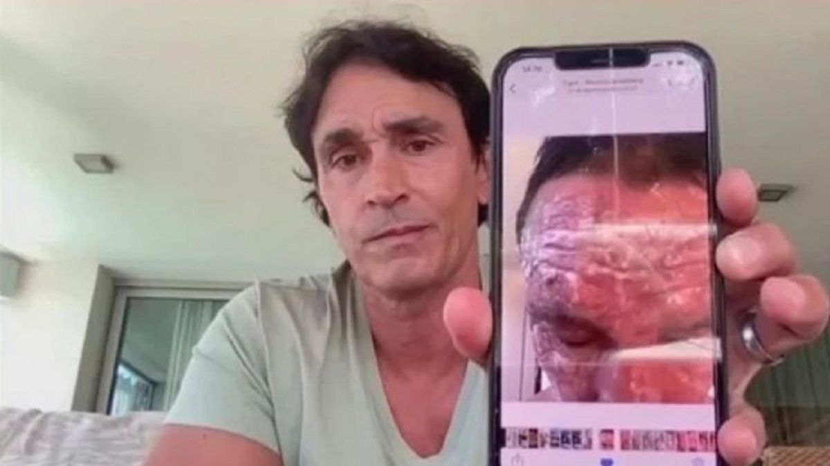 Sebastián Estevanez mostró cómo habían quedado sus quedamas