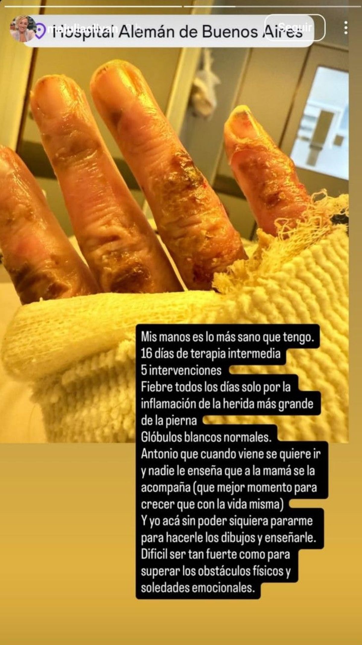 La impactante foto de María Julia Oliván que muestra cómo quedaron sus ...