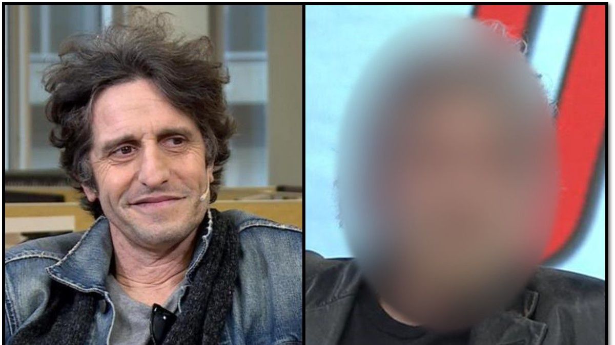 ¿Qué le pasó a Peretti?: Las fotos de su nuevo look lo muestran arruinado