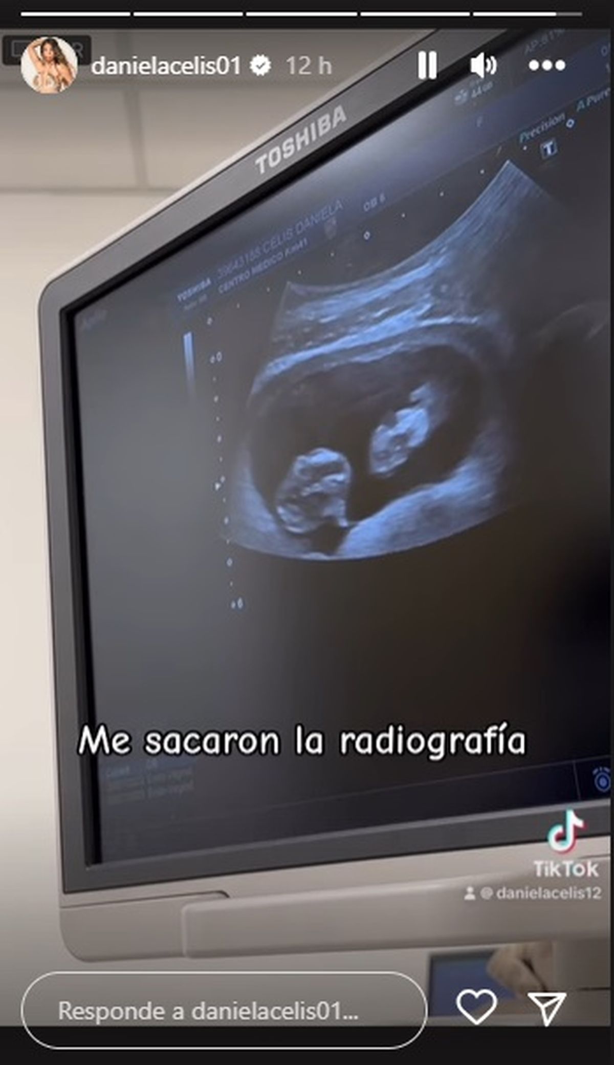 Daniela Celis mostró la primera imagen de sus gemelos